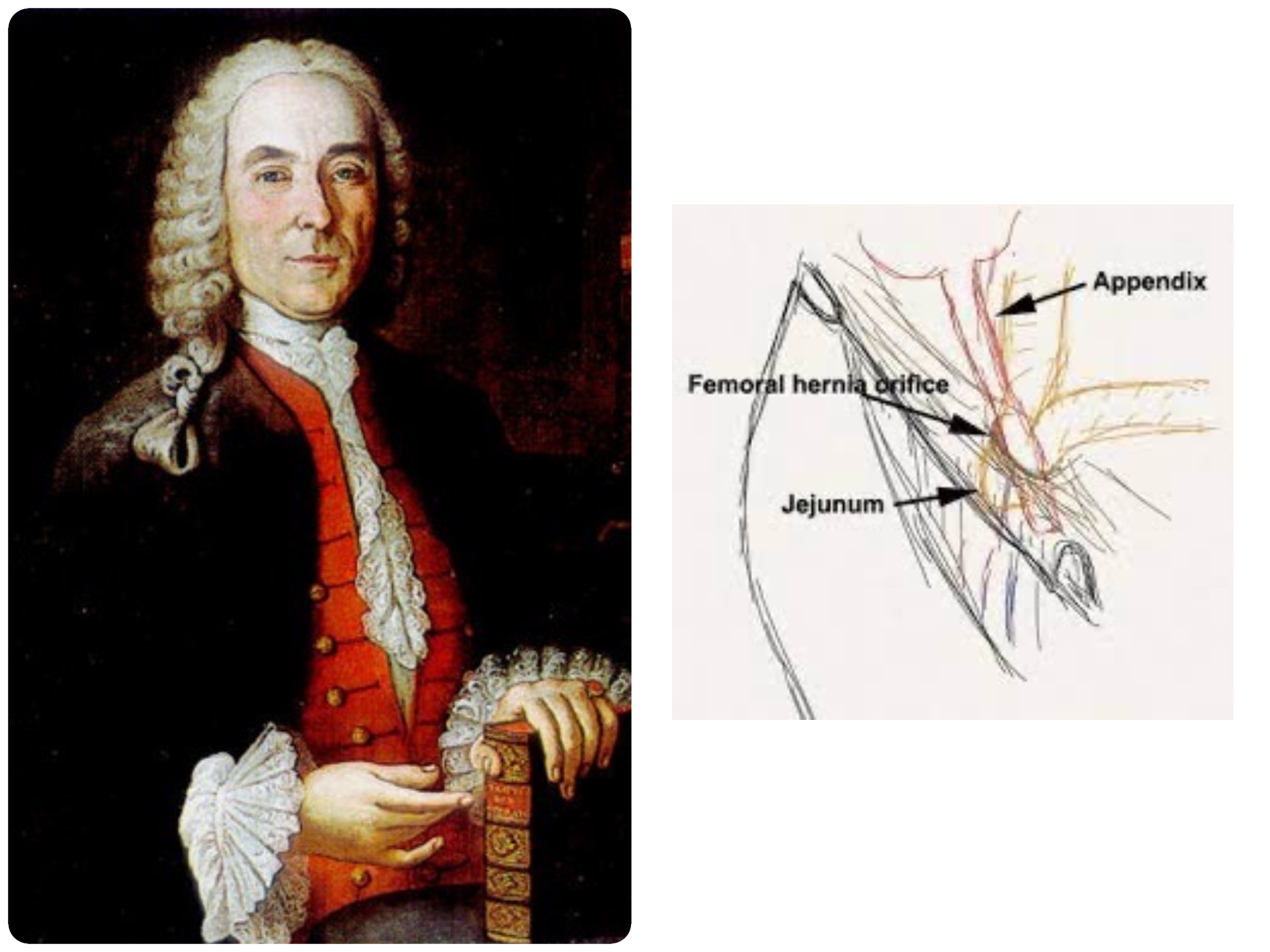 Another for the collection – Pen Paint and Scalpel